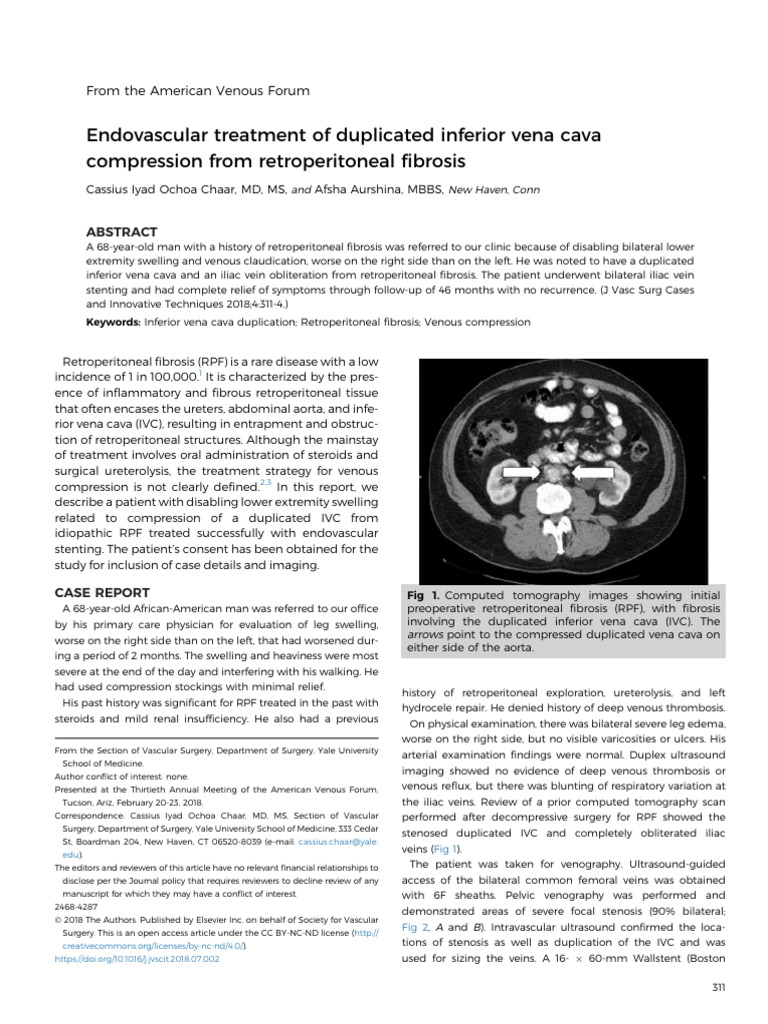 Endovascular Treatment of Duplicated Inferior Vena Cava Compression ...