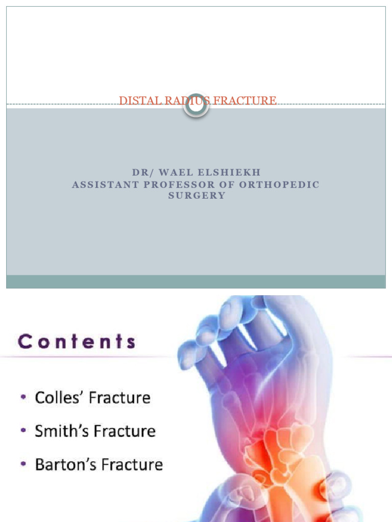 Distal Radius Fracture | PDF