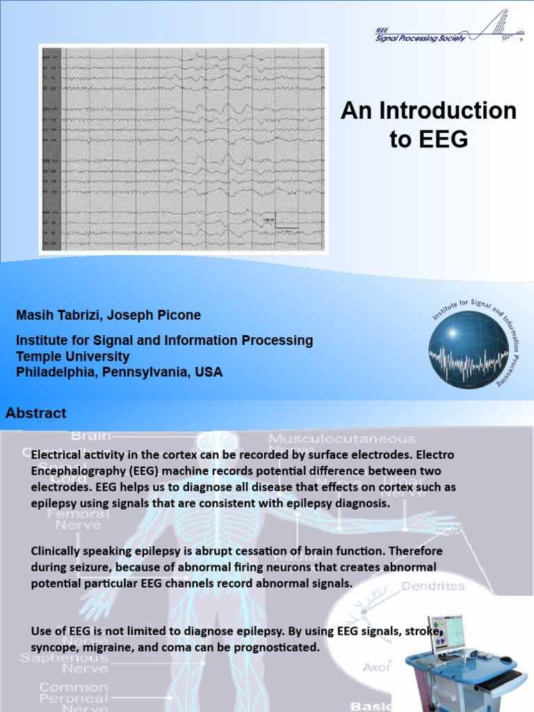 Presentation v01 | PDF | Electroencephalography | Epilepsy