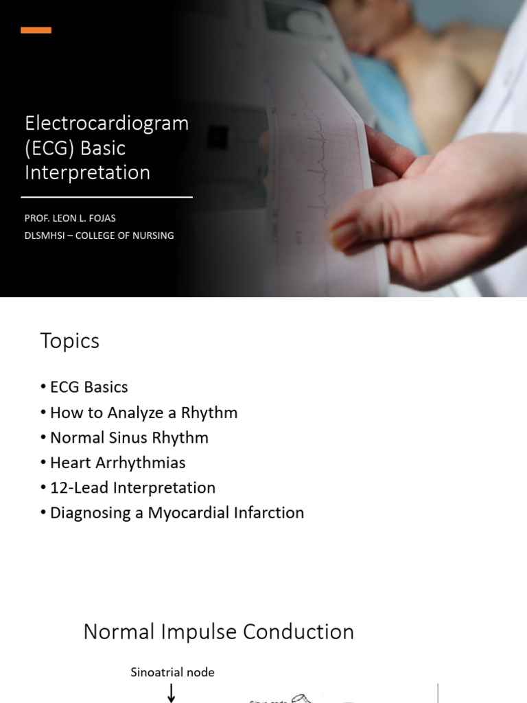 Basic Ecg Interpretation | PDF | Electrocardiography | Clinical Medicine