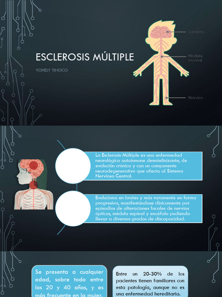 Esclerosis Múltiple Expo | PDF | Esclerosis múltiple | Medicina