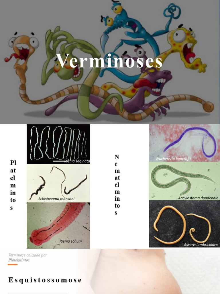 Aula_Verminoses | PDF | Imunologia | Parasitologia