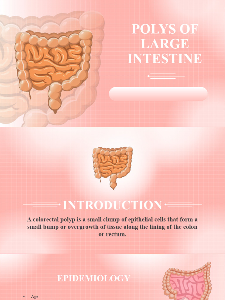 Polyps of Large Intestine | PDF | Colorectal Cancer | Colonoscopy