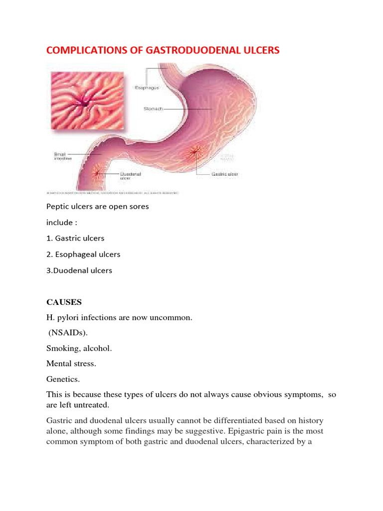 Material Study Complications Gastro-Duodenal Ulcers | PDF | Esophagus ...
