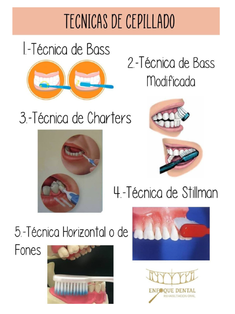 Tecnica de Cepillado | PDF