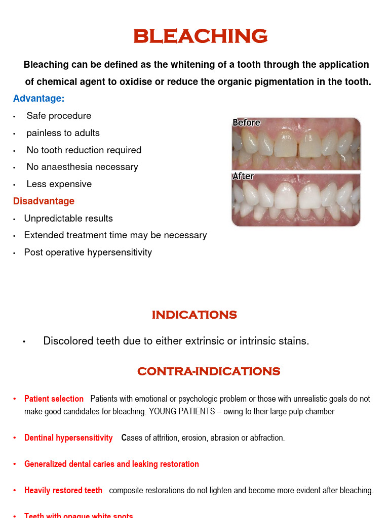 Bleaching Pdf Bleach Tooth Enamel