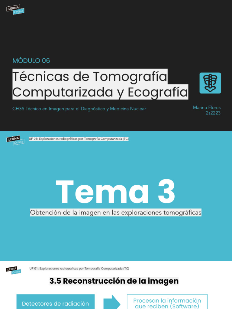 Vídeo-tutoría 5 - Tema 3.pptx (1) | PDF | Ct Scan | Imagenes medicas