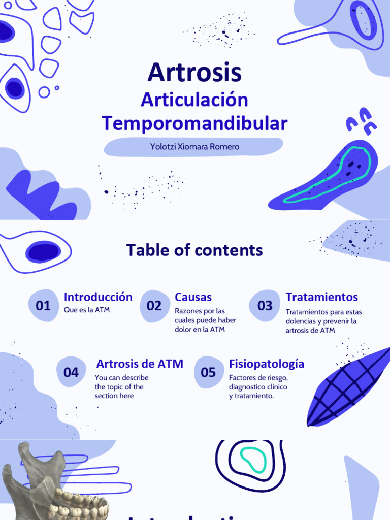 Artrosis ATM | PDF | Articulación | Osteoartritis