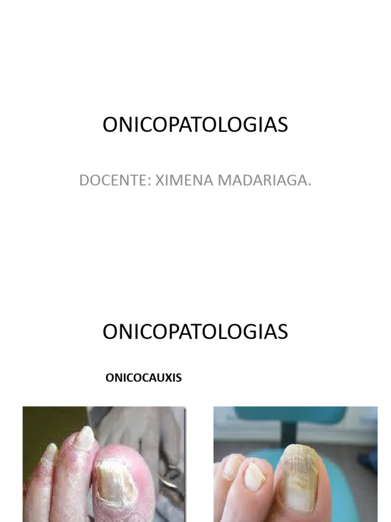 Guía de Onicopatologías y Tratamientos | PDF