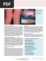 Tratamiento Dermatitis Atópica GPC | PDF | Alergia | Inmunología