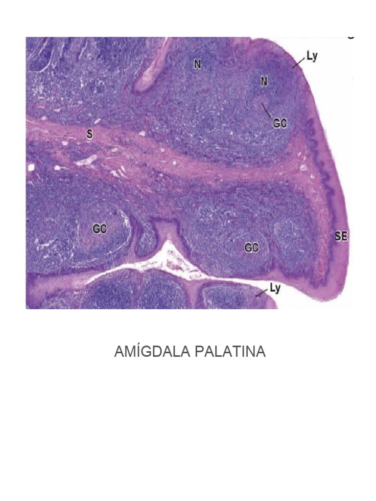 Histología de la Amígdala Palatina | PDF