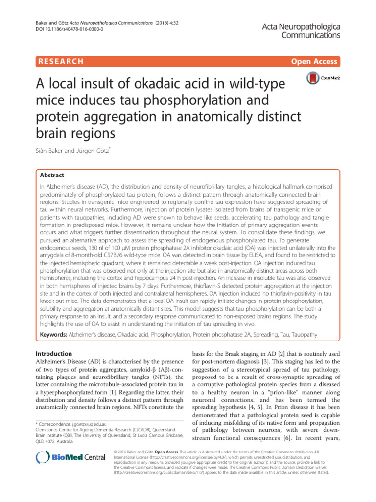 A Local Insult of Okadaic Acid in Wild-Type Mice Induces Tau ... A Local Insult of Okadaic Acid in Wild-Type Mice Induces Tau ...