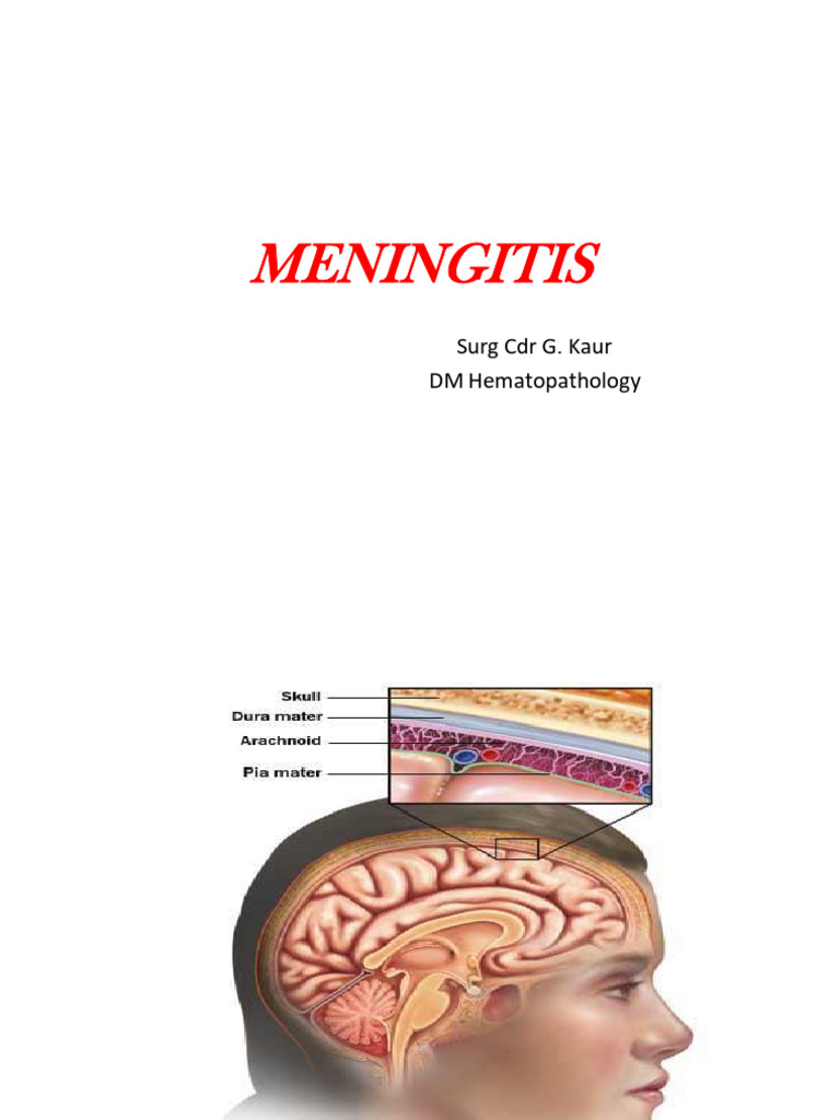 Meningitis Microbiology | PDF | Cerebrospinal Fluid | Meningitis