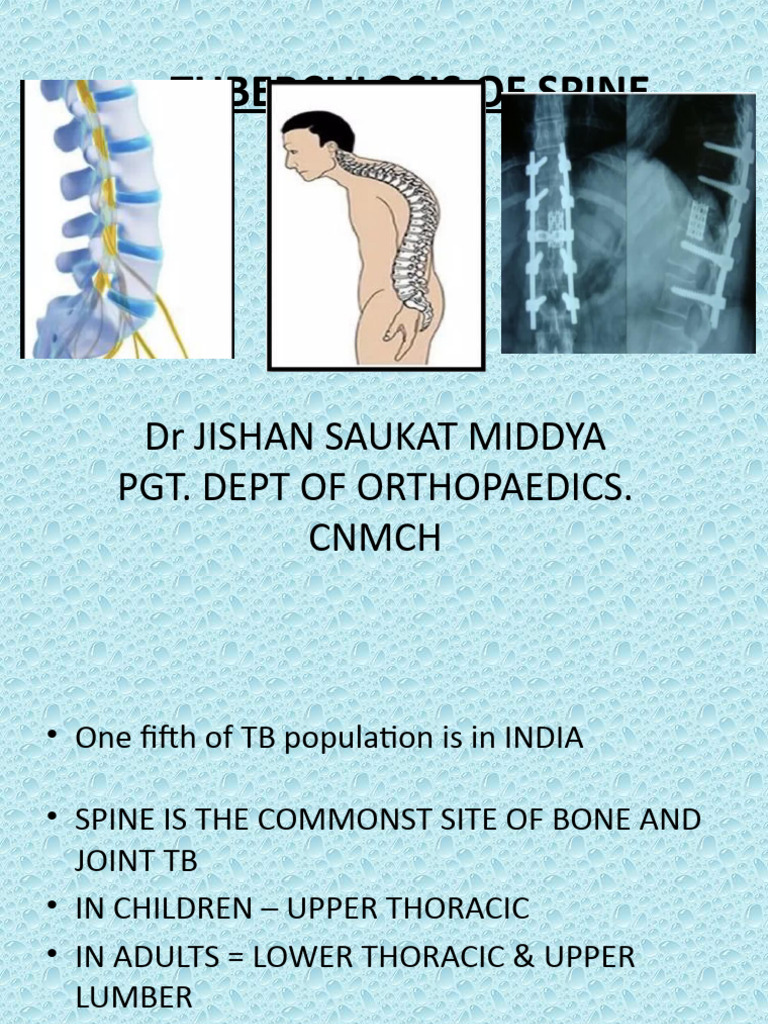 Tuberculosis of Spine | PDF | Vertebra | Vertebral Column