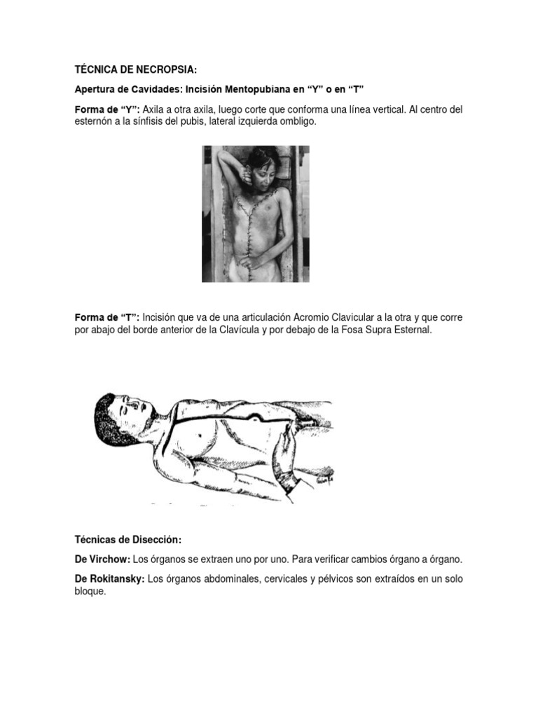 Técnica de Necropsia | PDF | Autopsia | Muerte