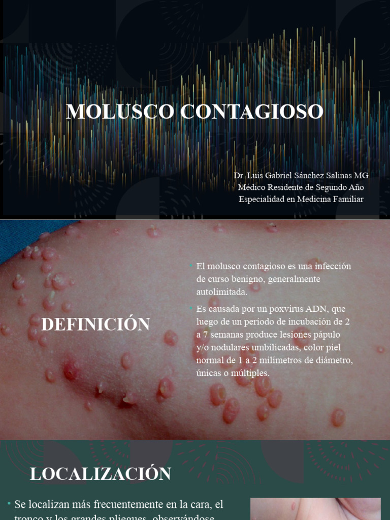 Molusco Contagioso | PDF | Virus | Epidemiología