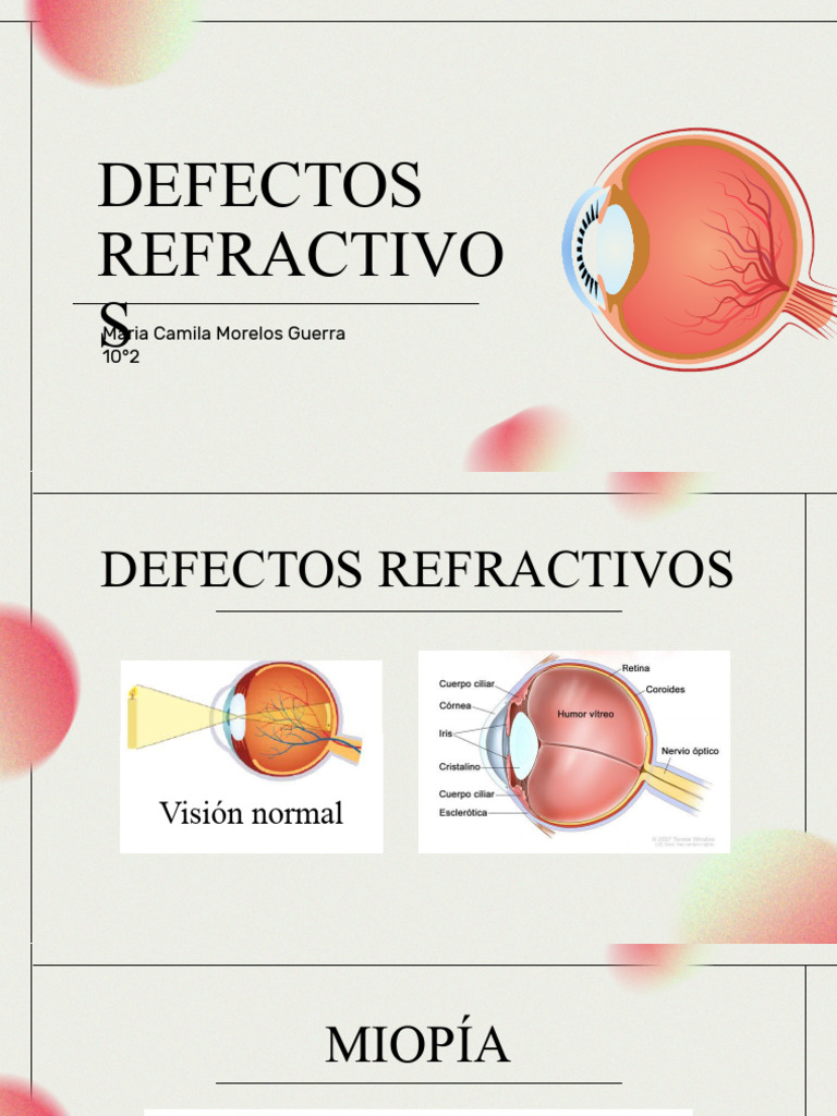 Defectos_Refractivos_Maria_Camila_Morelos_Guerra_10°2 | PDF
