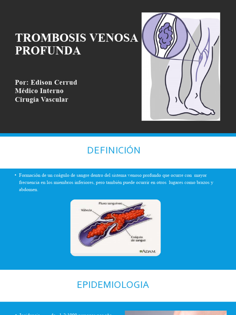 Trombosis Venosa Profunda | PDF | Trombo | Especialidades Medicas