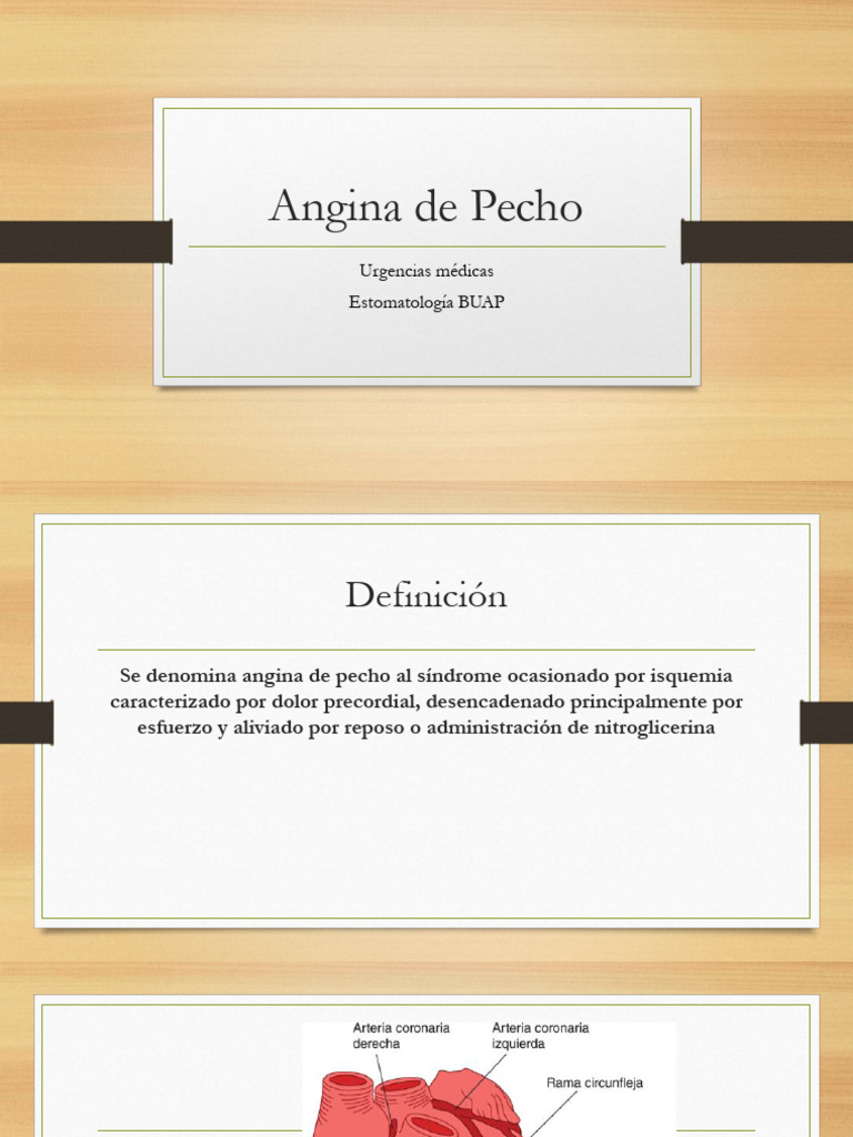 Síntomas y Manejo de Angina de Pecho | PDF | Medicina CLINICA ...