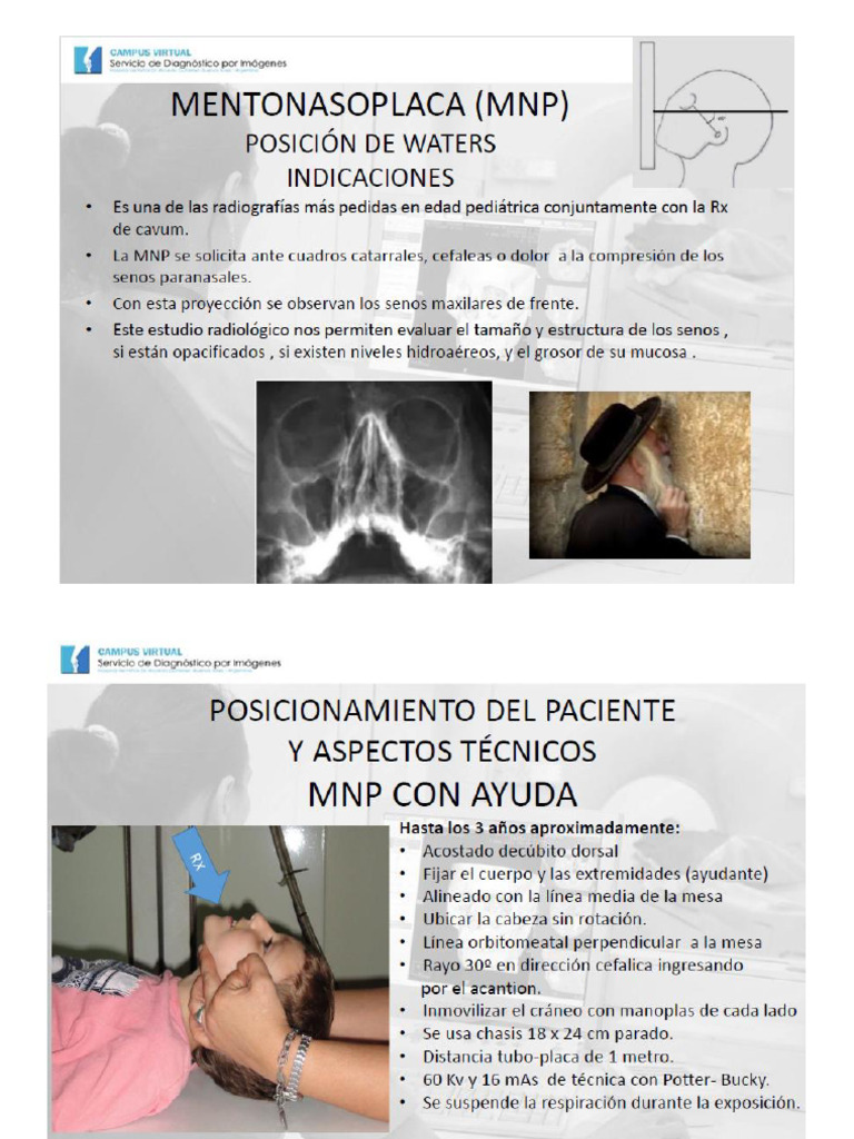 Actividad Asincrónica MNP - FNP - Towne - Nasales | PDF