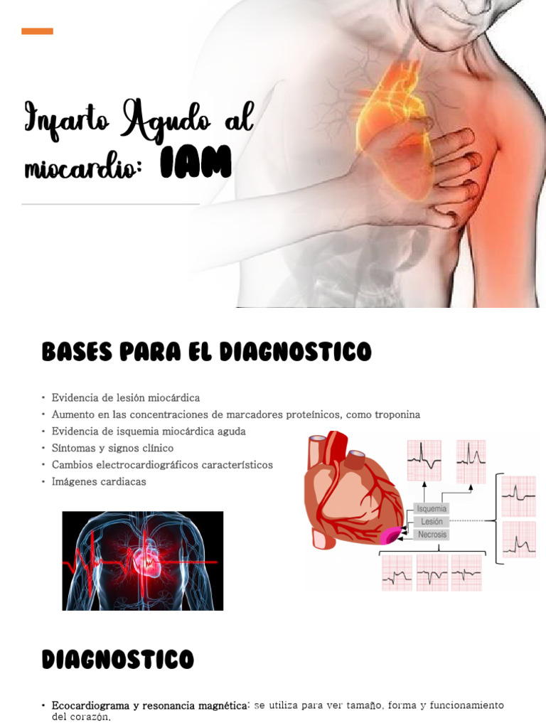 Iam | PDF | Infarto de miocardio | Corazón