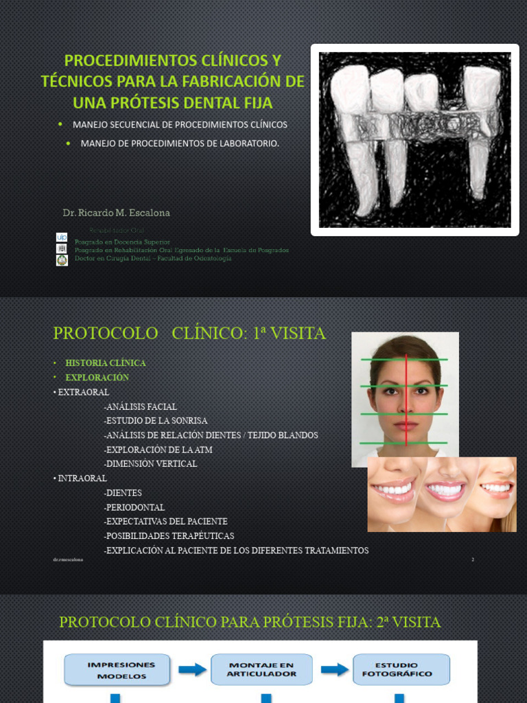 Protocolo para Prótesis Dental Fija | PDF | Dentadura postiza | Color
