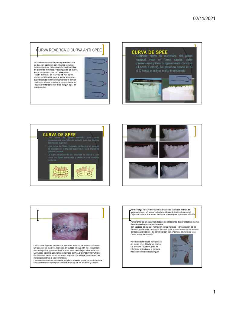 Curvas Reversas en Ortodoncia: Guía Práctica | PDF | Boca | Anatomia dental