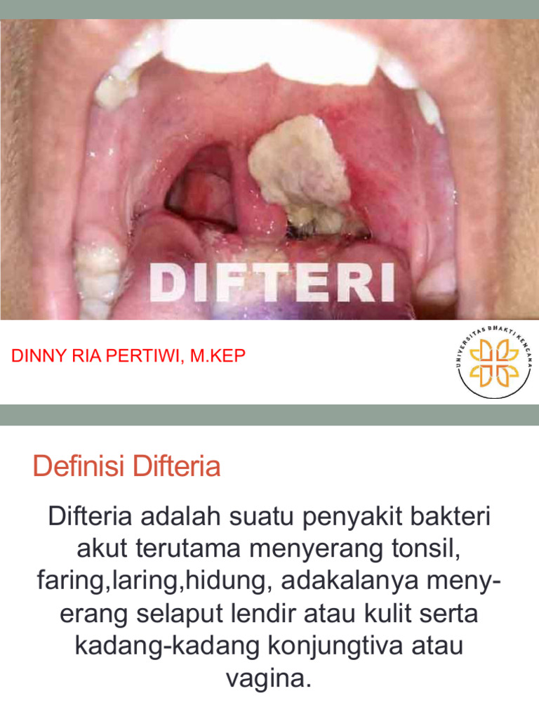 Difteri Compressed | PDF