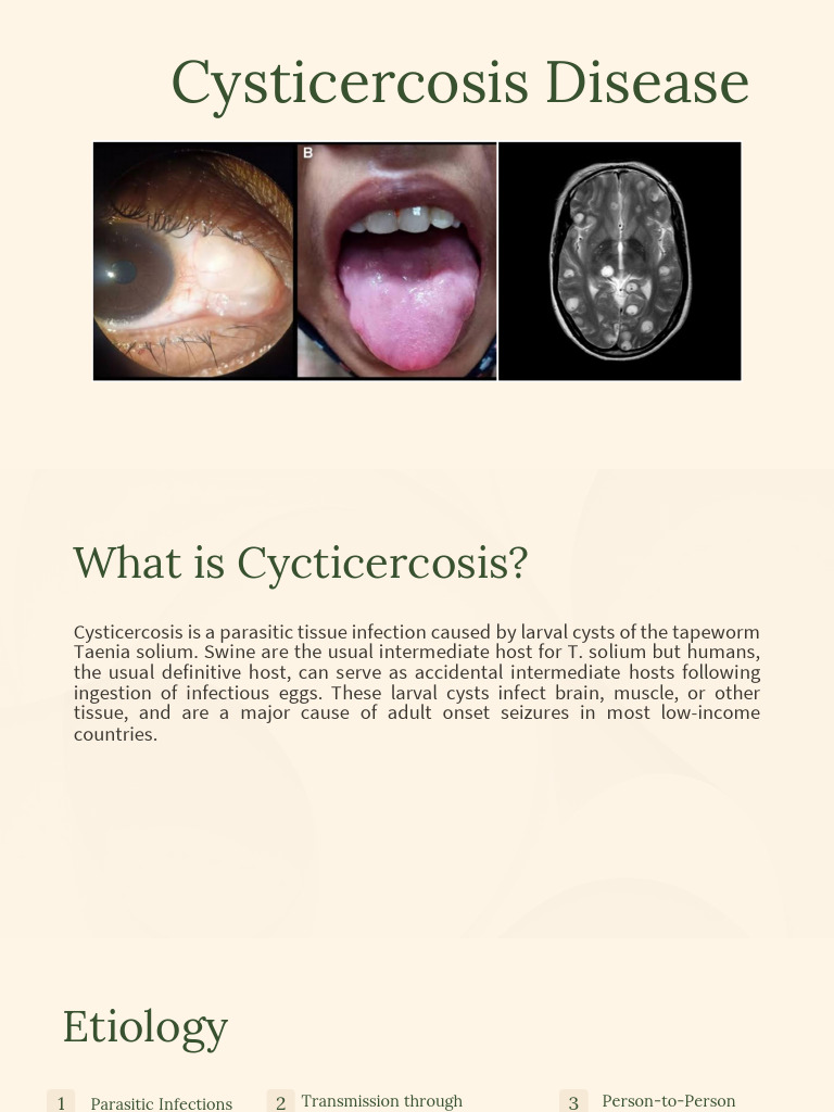 Cysticercosis | PDF | Medical Specialties | Clinical Medicine