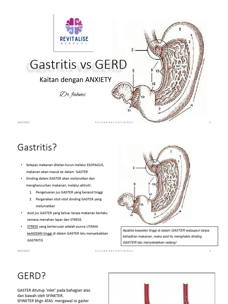 Gastritis Vs GERD | PDF