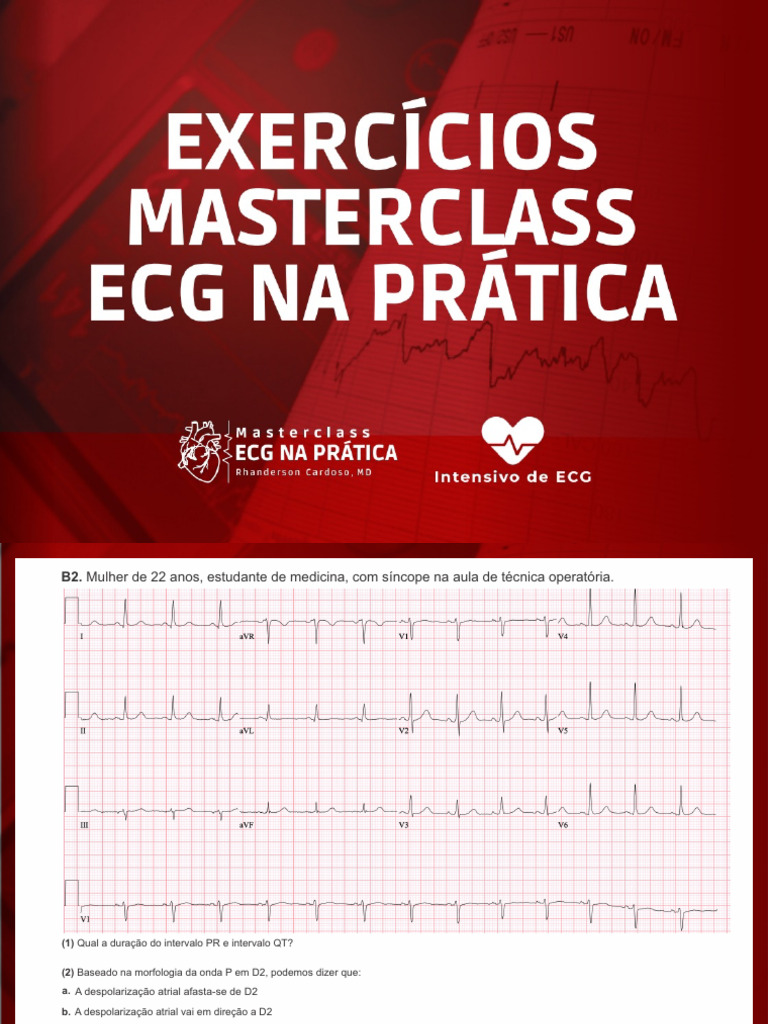 Lista de Exercícios - Masterclass ECG na Prática | PDF