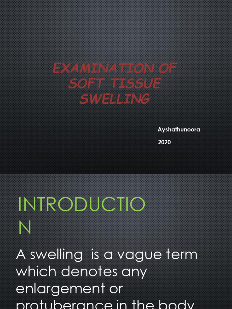Soft Tissue Swelling | PDF | Neoplasms | Edema