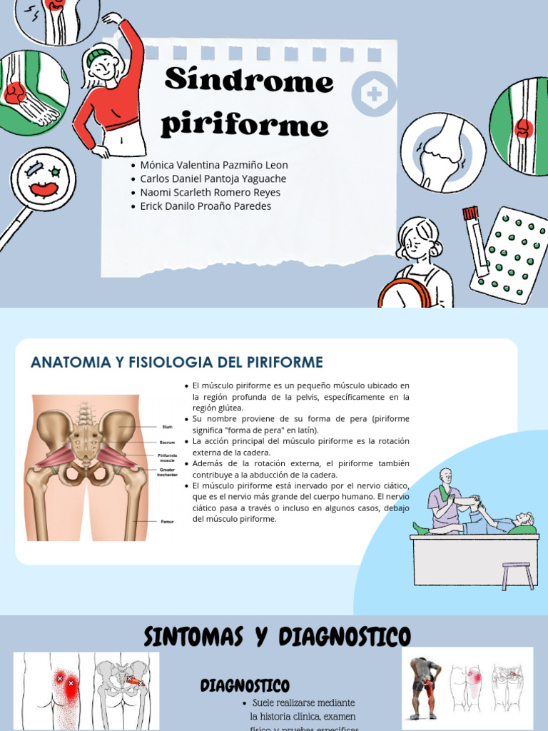 Síndrome Piriforme | Descargar gratis PDF | Anatomía humana | Anatomía ...