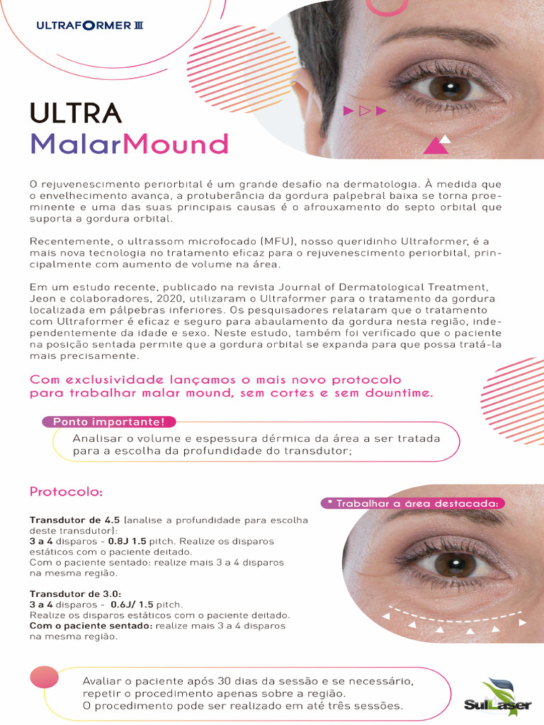Protocolo Malar Mound | PDF