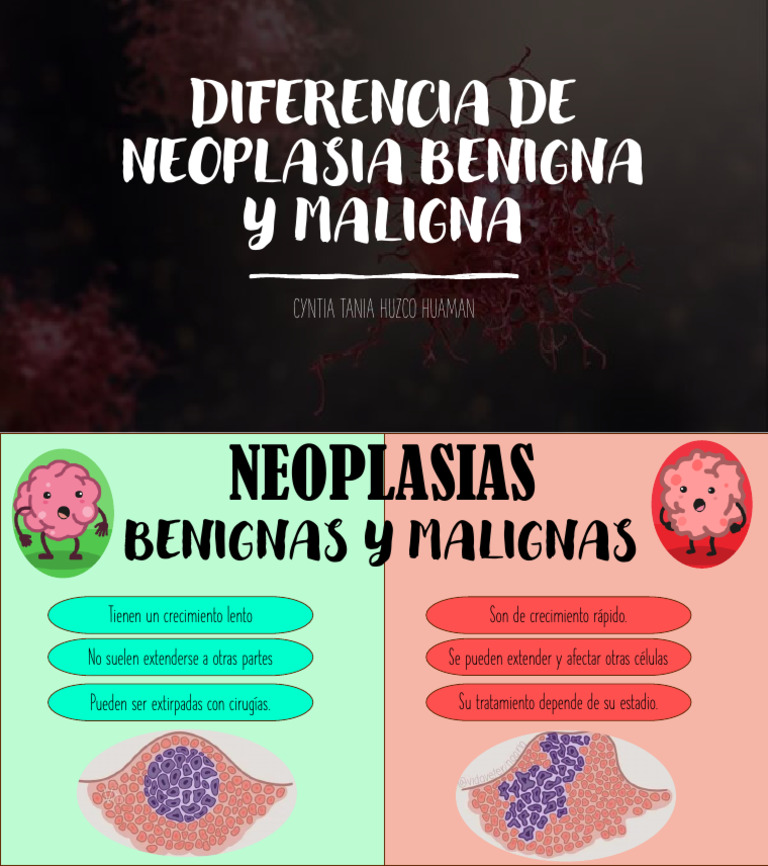 DIFERENCIA DE NEOPLASIA BENIGNA Y MALIGNA | PDF