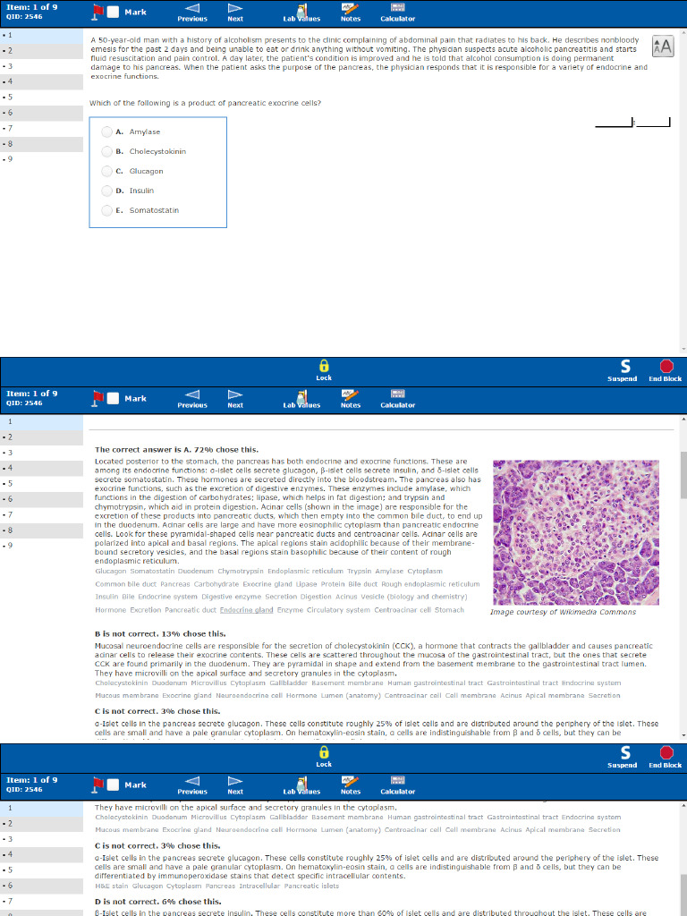 Usmle RX Qbank 2017 Step 1 Gastroenterology Histology | PDF | Pancreas ...