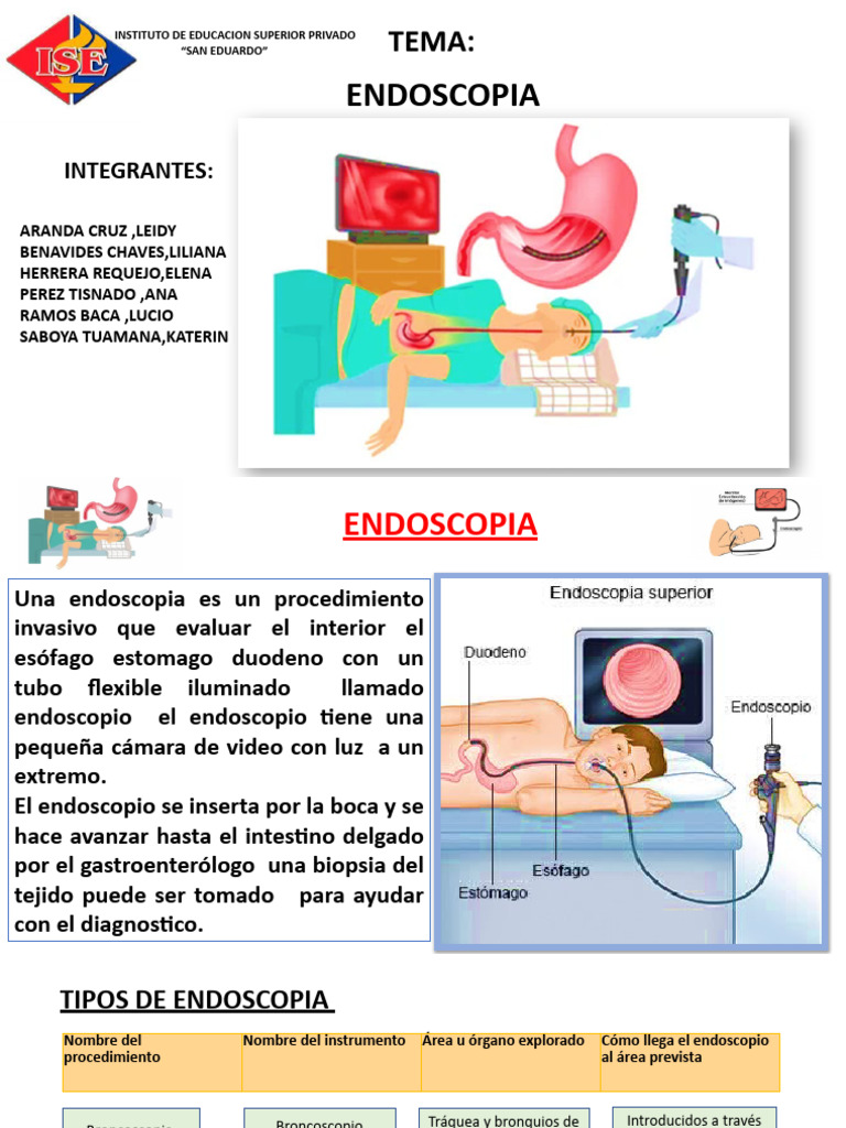 Endoscopia Grupo333 | PDF | Endoscopia | Medicina CLINICA