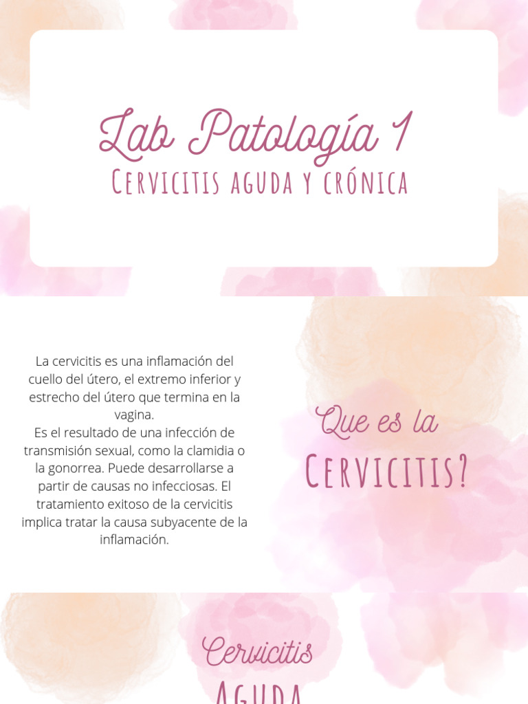 Cervicitis: Causas y Tratamientos | PDF | Vagina | Inflamación