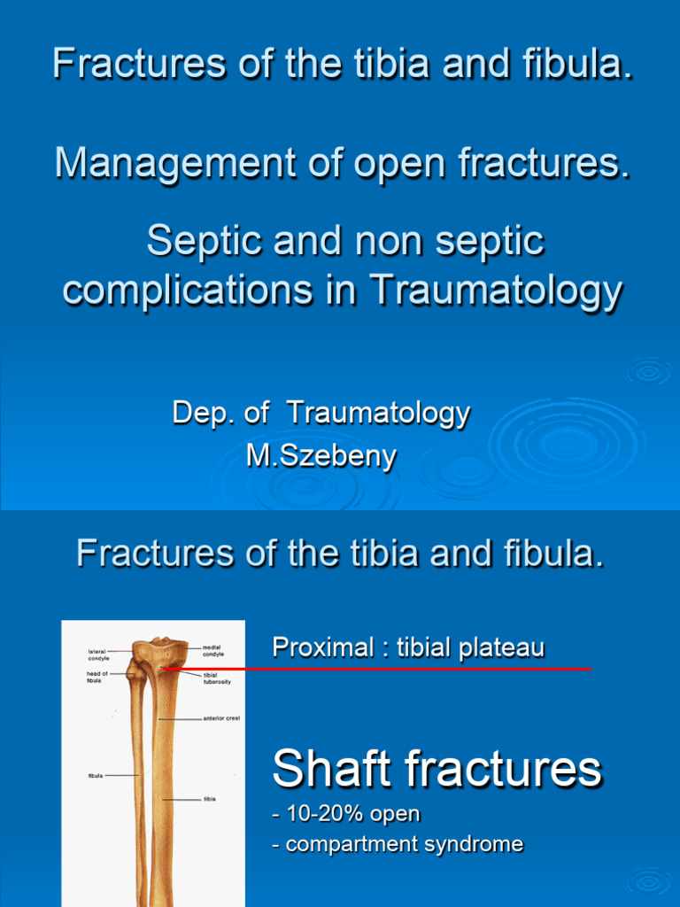 Management of Open Fractures Prof A Sárváry Septic and Non Septic Complications in Traumatology ...
