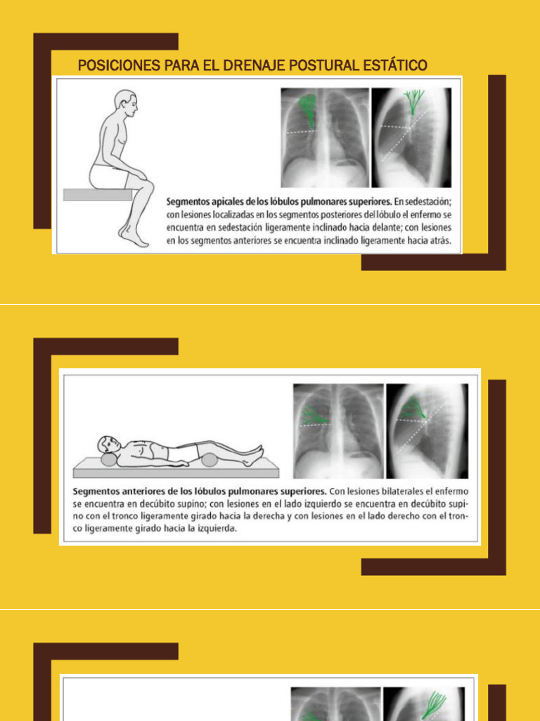 Posiciones para El Drenaje Postural Estático y Dinamico | PDF