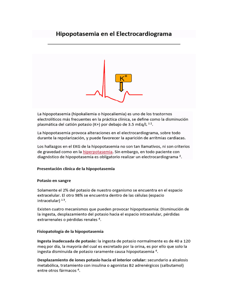 Hipopotasemia en El Electrocardiograma | PDF | Potasio | Química