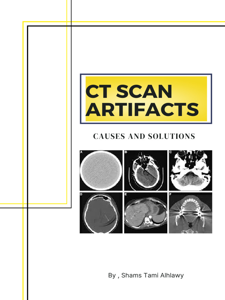 CT Scan Artifacts 1681725878 | PDF | Ct Scan | X Ray