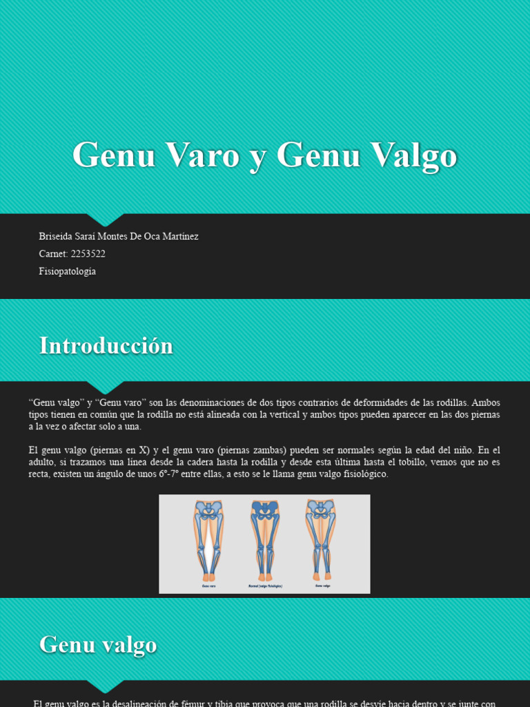 Genu Varo y Genu Valgo | PDF | Rodilla | Enfermedades y trastornos