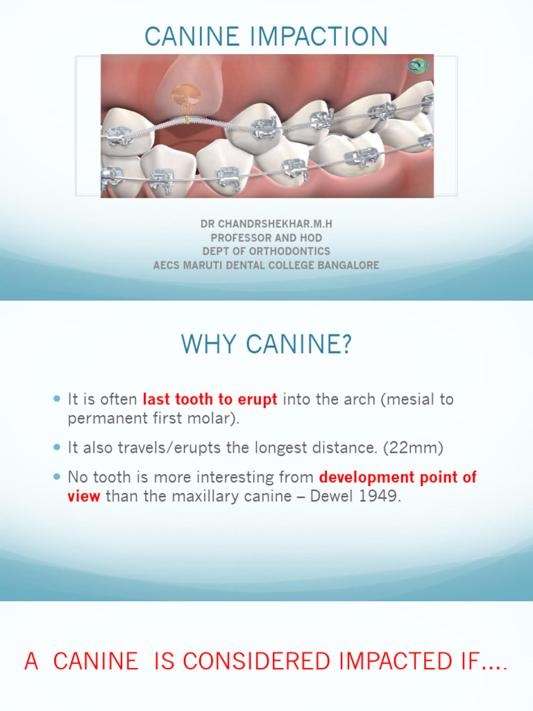 Canine Impaction Final Ppt PDF | PDF | Dental Anatomy | Dentistry