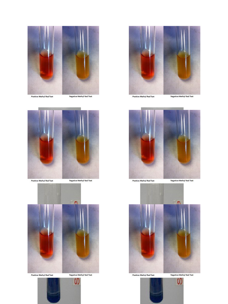 MR Test and Citrate Test | PDF