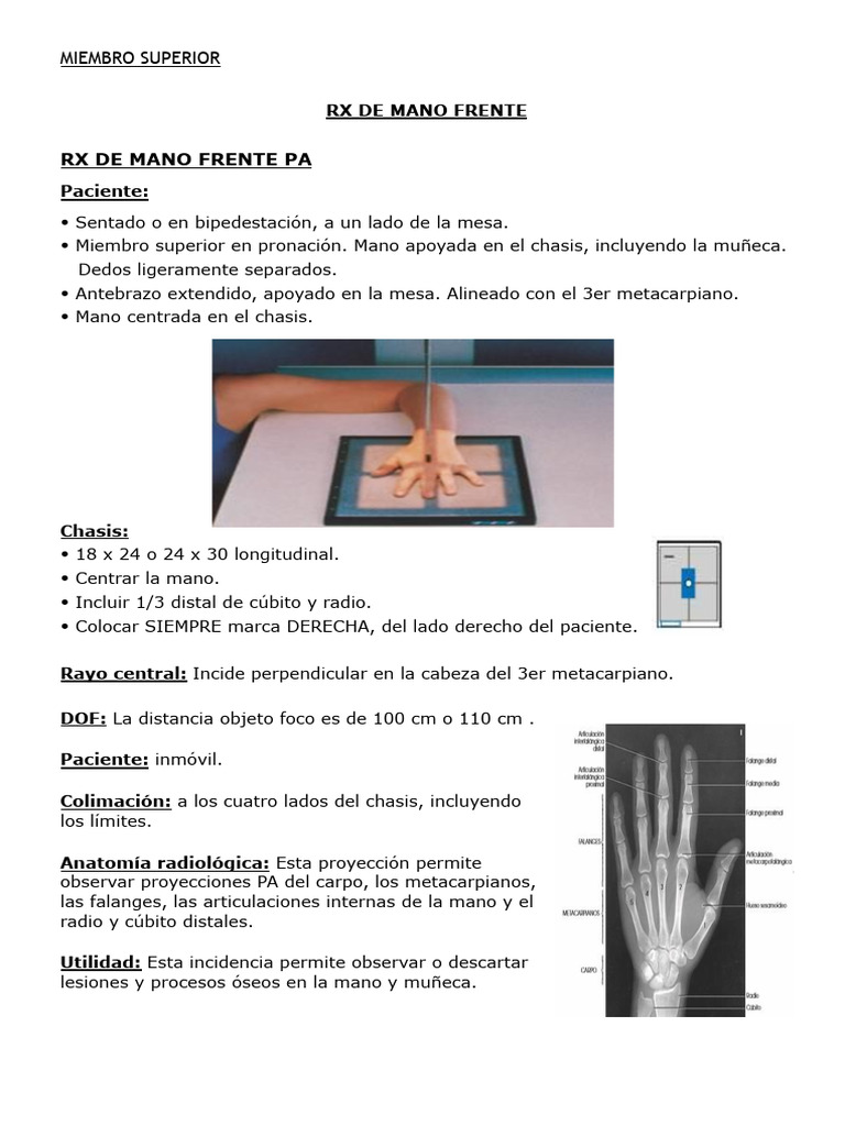 RX de Mano Frente | PDF | Mano | Anatomía