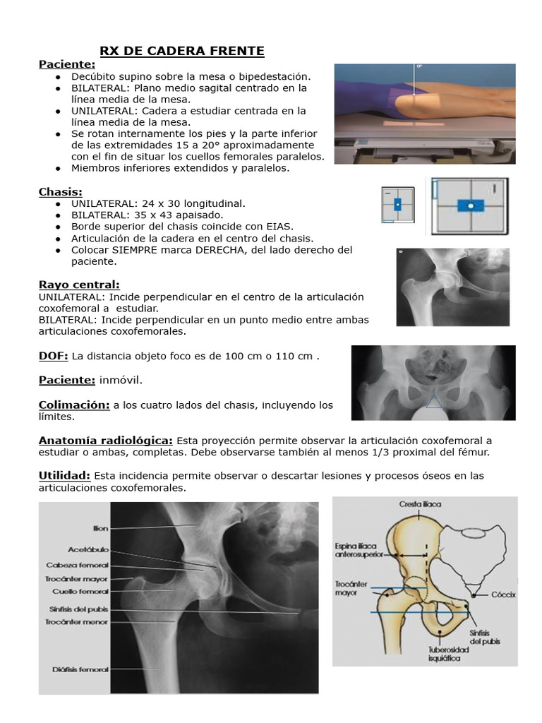 9 - RX - de Cadera Frente | PDF | Sistema musculoesquelético