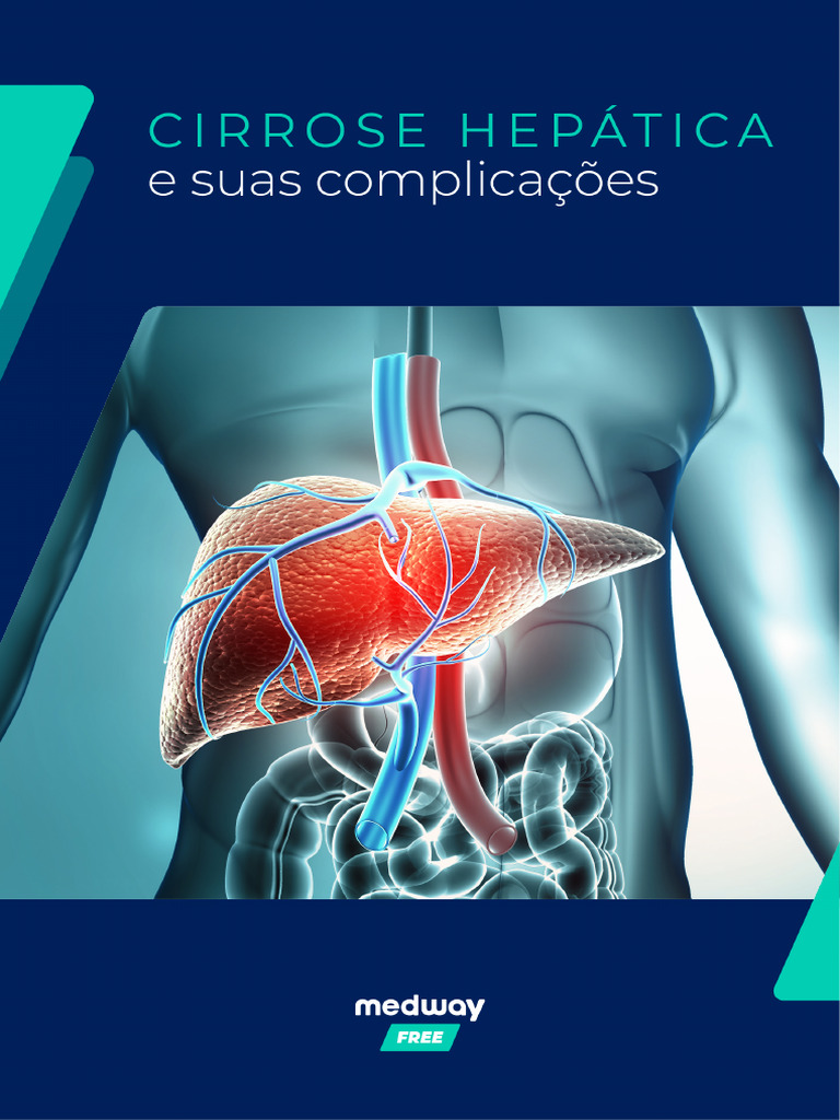 Ebook Cirrose Hepatica e Suas Complicacoes | PDF | Fígado | Cirrose
