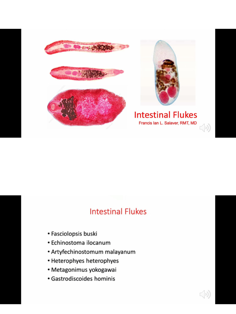 Intestinal Flukes | PDF
