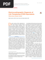 Sgarbossa Criteria - LITFL - ECG Library Diagnosis | PDF ...